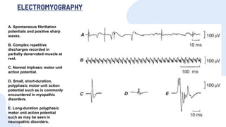 investigations in neurology powerpoint presentation | PPTX