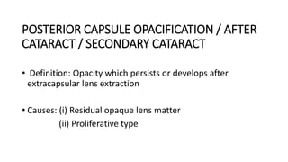 After cataract.pptx