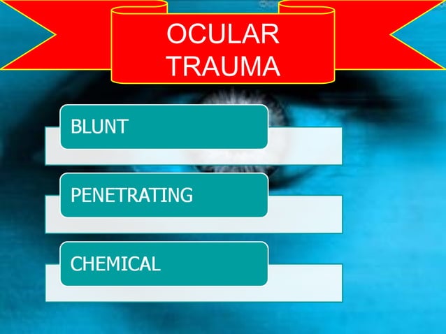 EYE TRAUMA | PPT | Eye and Vision Conditions | Diseases and Conditions
