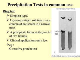 Antigen - antibody reaction based on medical science | PPT