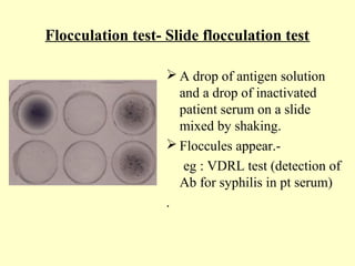 Antigen - antibody reaction based on medical science | PPT