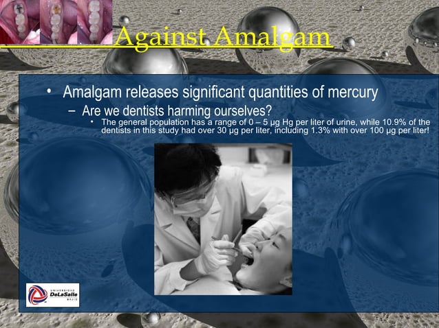 Against Amalgam | PPT