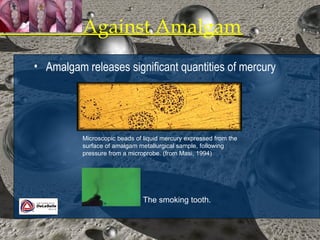 Against Amalgam | PPT