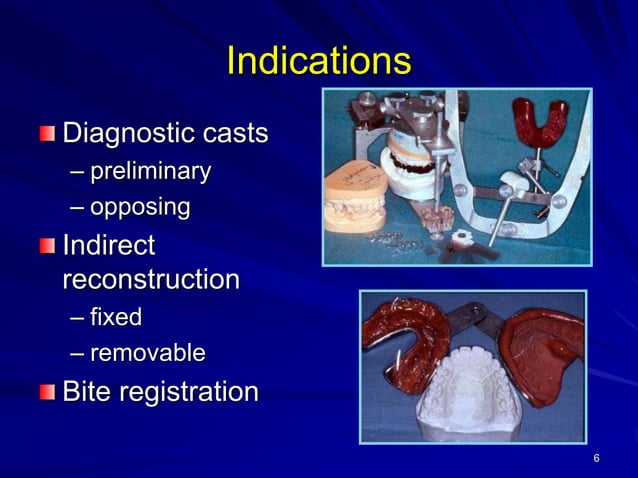 agar agar and alginate impression materials | PPT