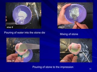 agar agar and alginate impression materials | PPT