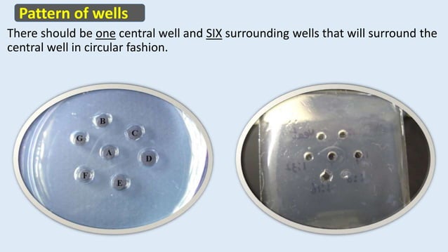 Agar Gel Precipitation Test (AGPT).pptx