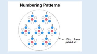 Agar Gel Precipitation Test (AGPT).pptx