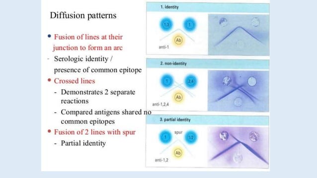 Agar Gel Precipitation Test (AGPT).pptx