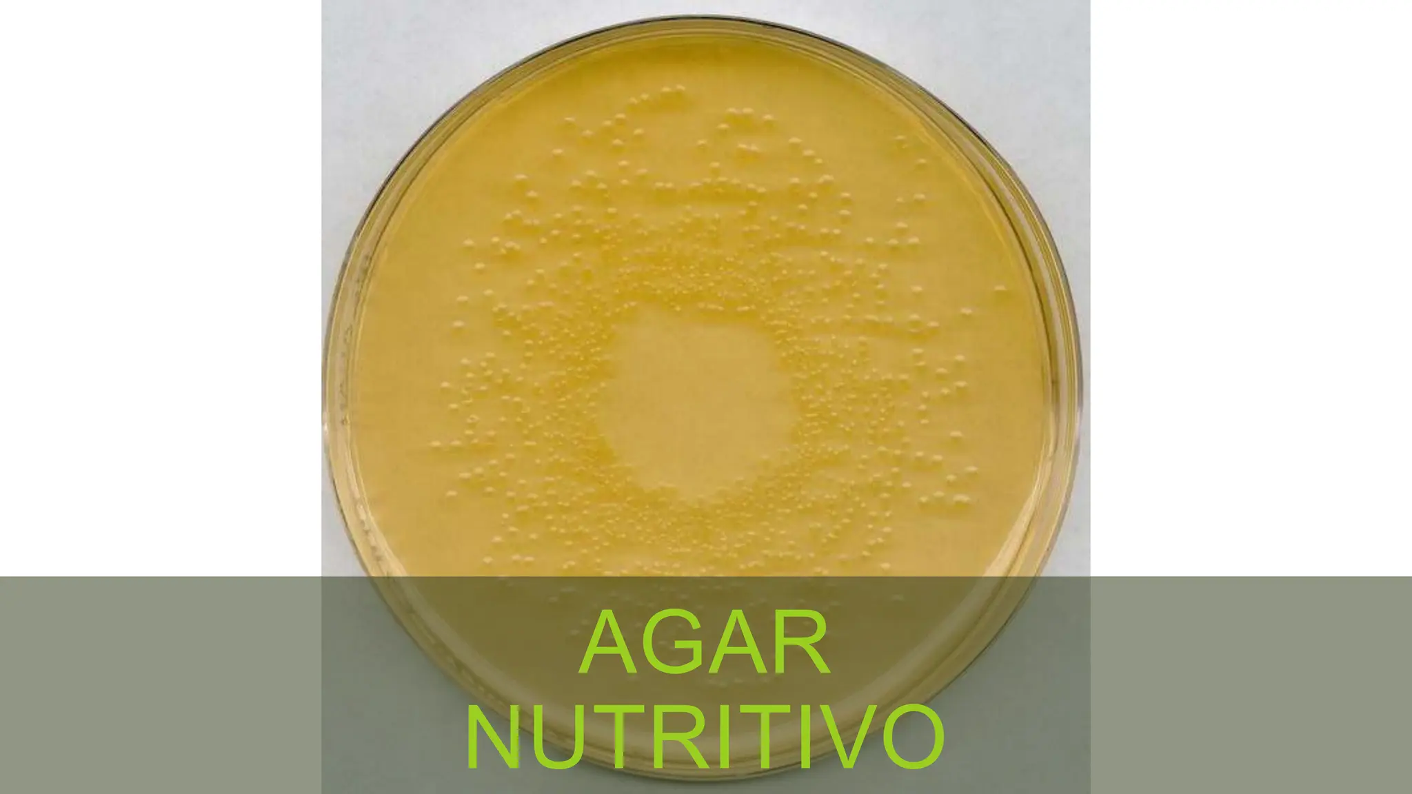 Agar nutritivo para practicar de laboratori .pptx