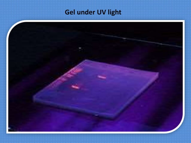 Agarose gel electrophoresis | PPT