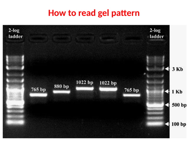 Protocols of DNA Agarose gel electrophoresis | PPTX