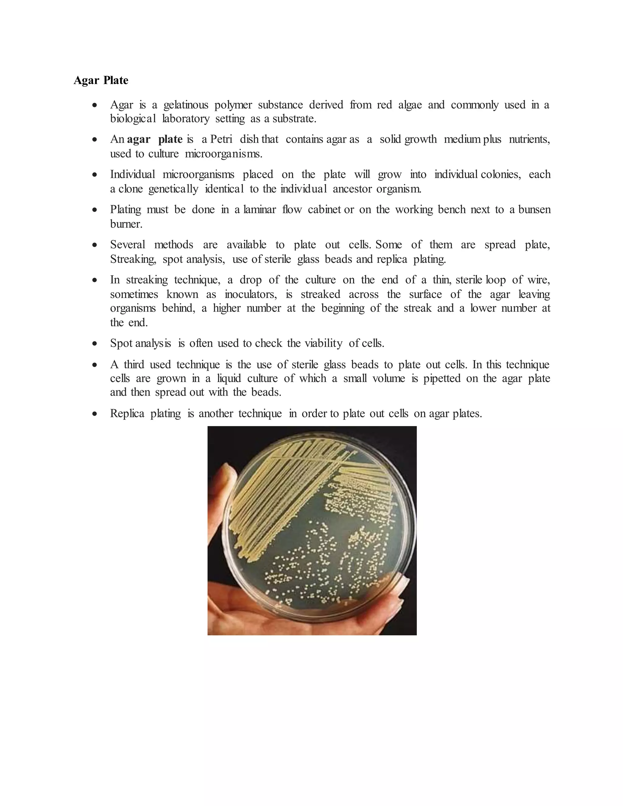Agarplate Strek The Streak Plate Protocol