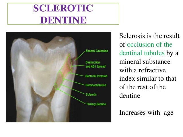 Age changes in oral tissues