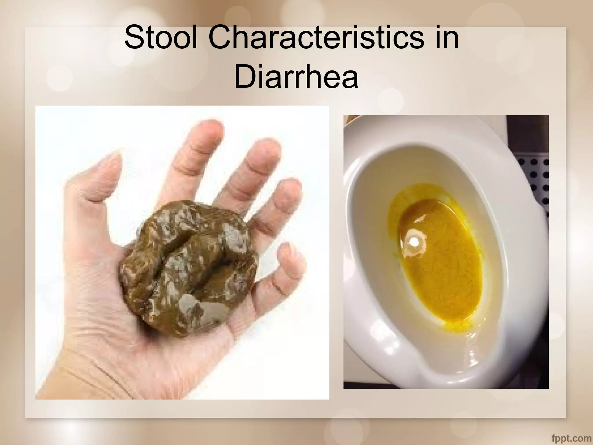 Acute Gastroenteritis for Adults and Children | PPT