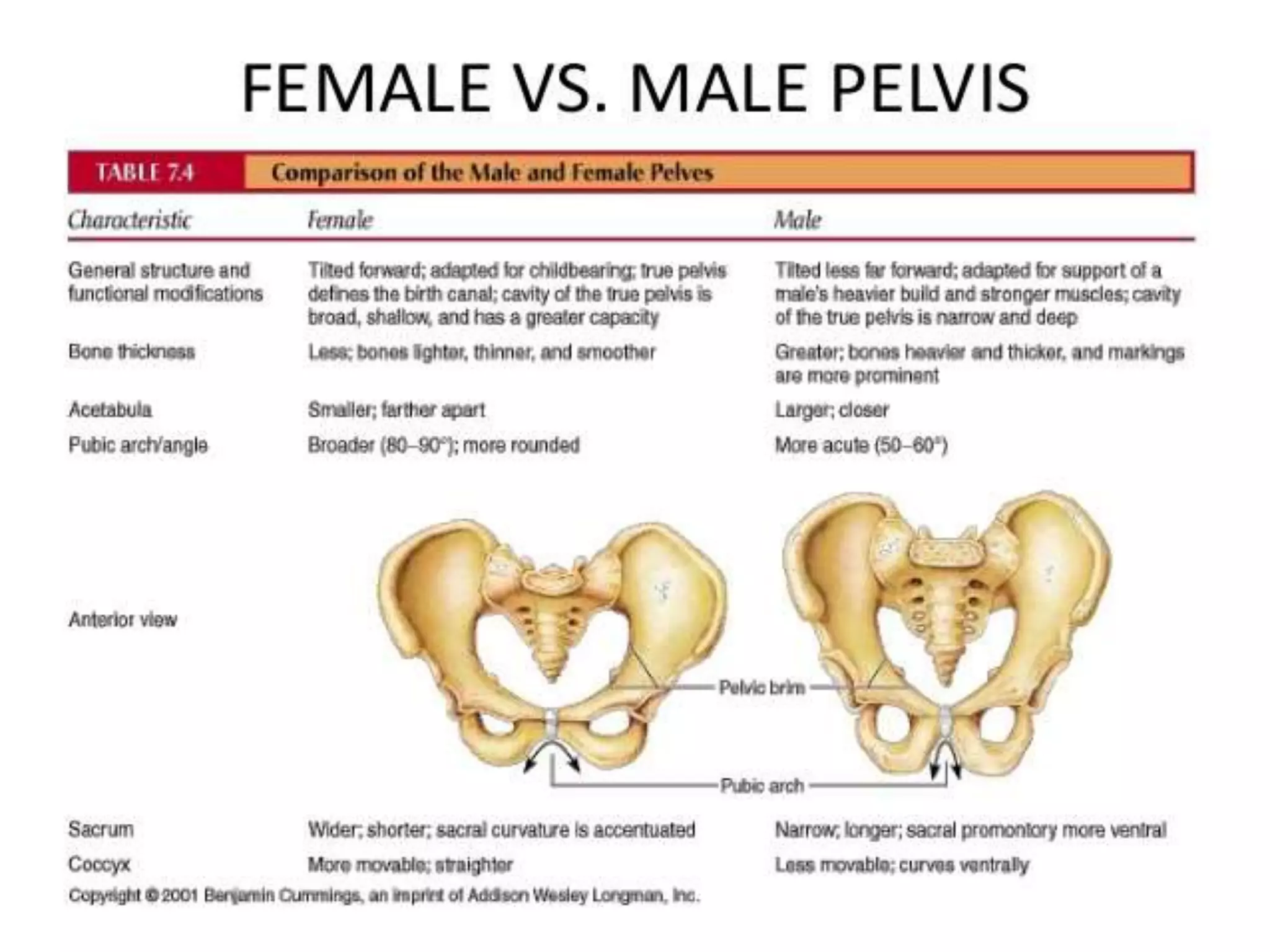 Age and sex ditermination from pelvis | PPTX