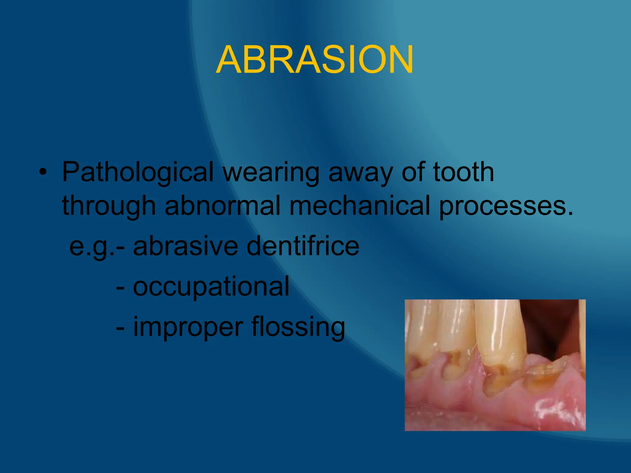 Age changes in enamel, dentin and pulp1.pptx