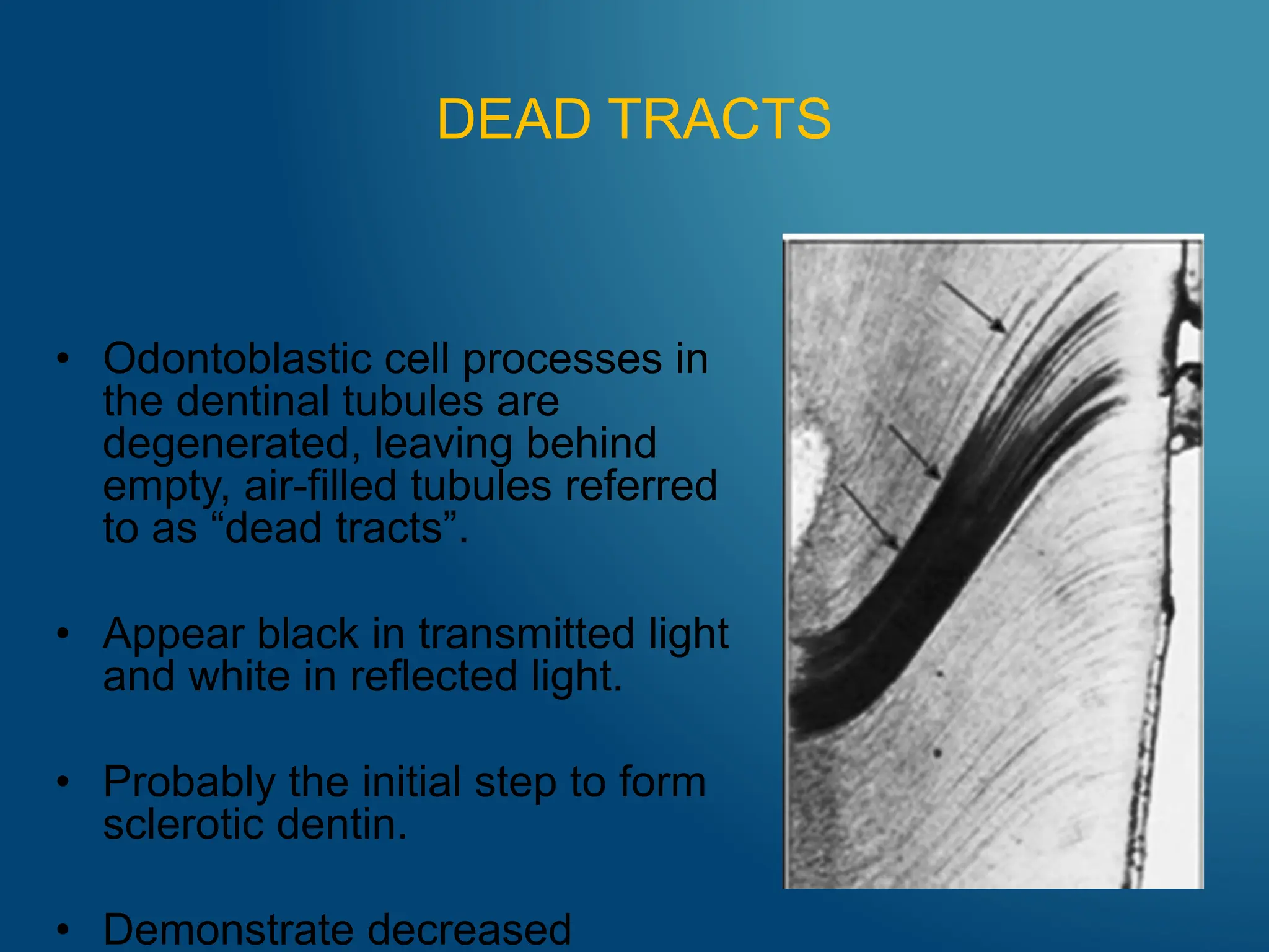 Age changes in enamel, dentin and pulp1.pptx