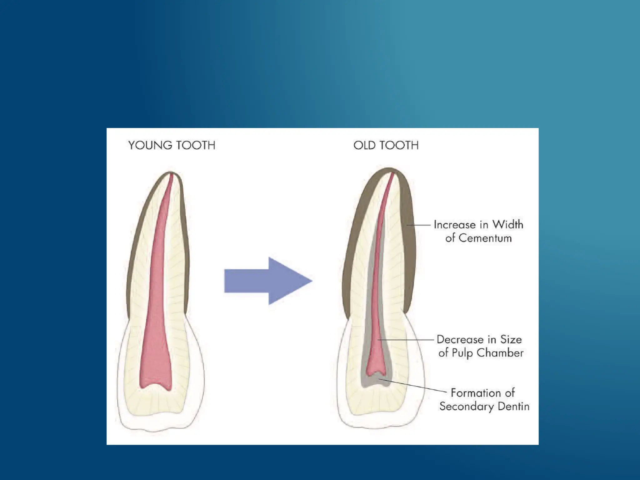 Age changes in enamel, dentin and pulp1.pptx