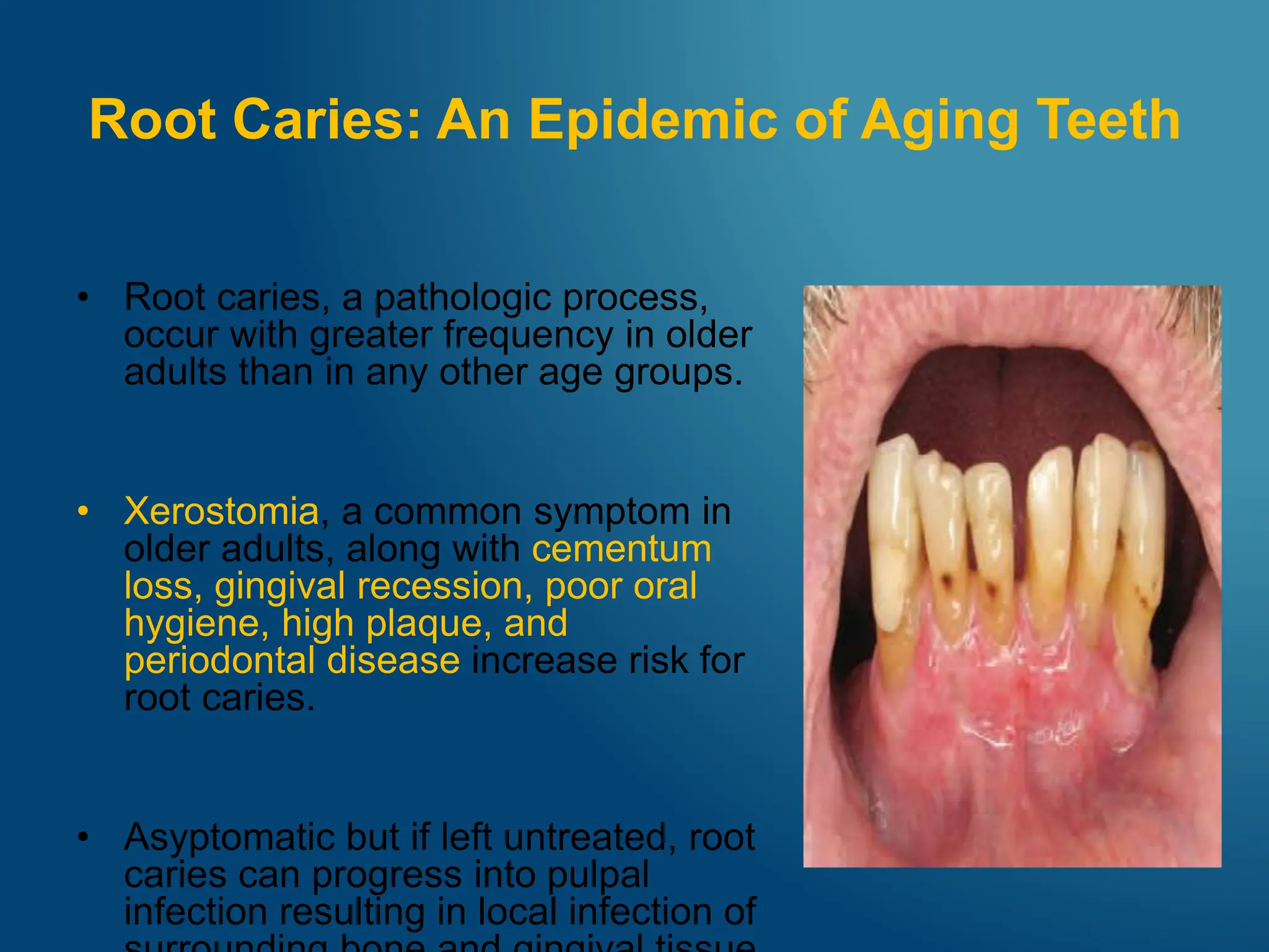Age changes in enamel, dentin and pulp1.pptx