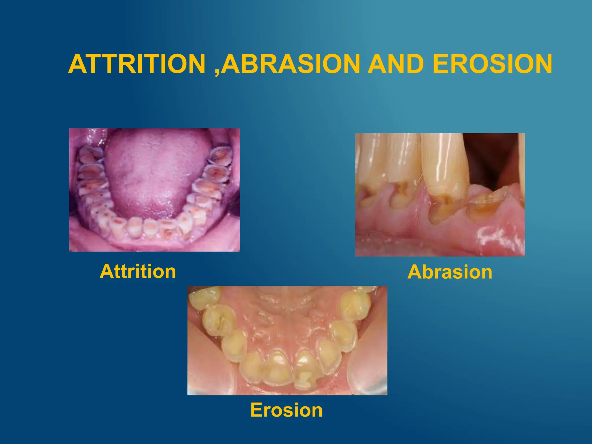 Age changes in enamel, dentin and pulp1.pptx