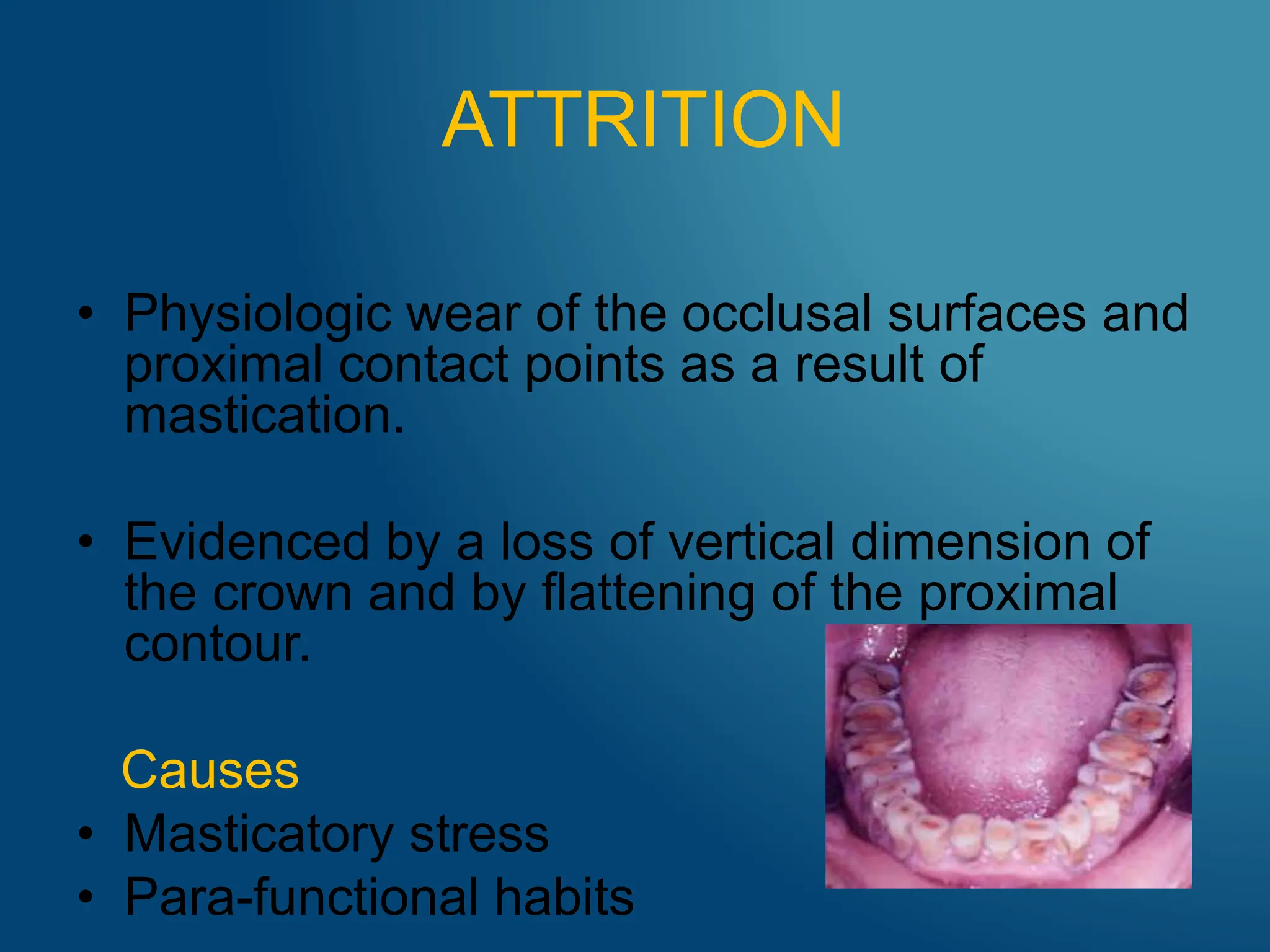 Age changes in enamel, dentin and pulp1.pptx