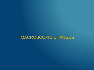 Age changes in enamel, dentin and pulp1.pptx