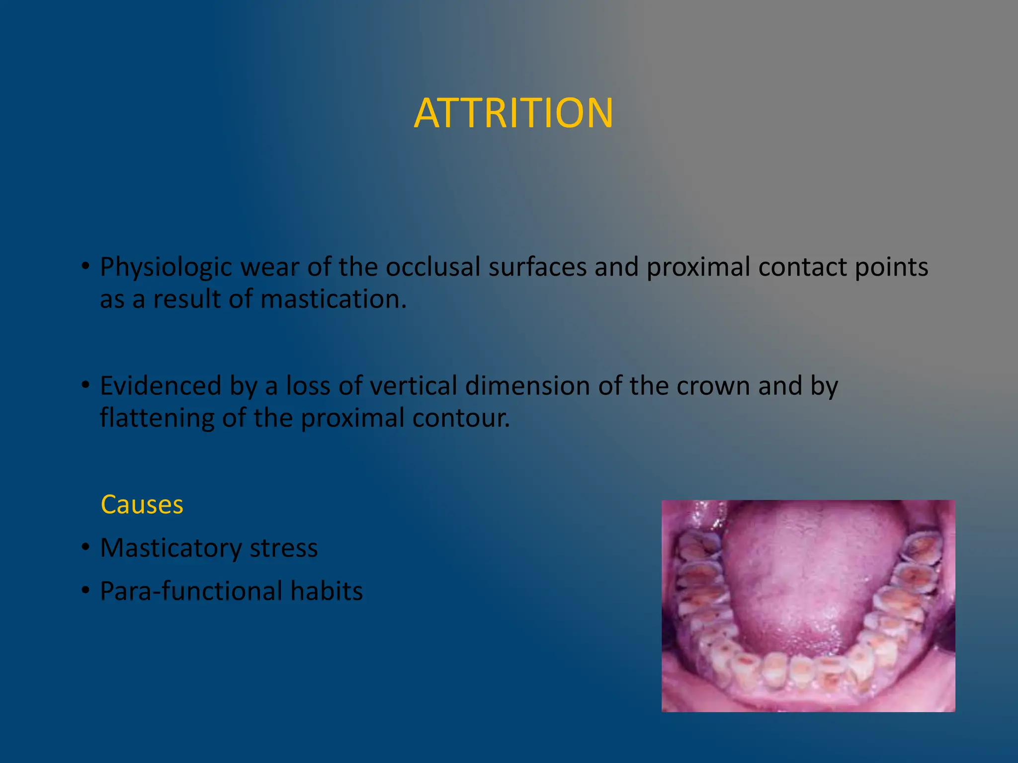 Age changes in enamel, dentin and pulp1.pptx