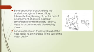 age changes in maxilla pptx...............pptx
