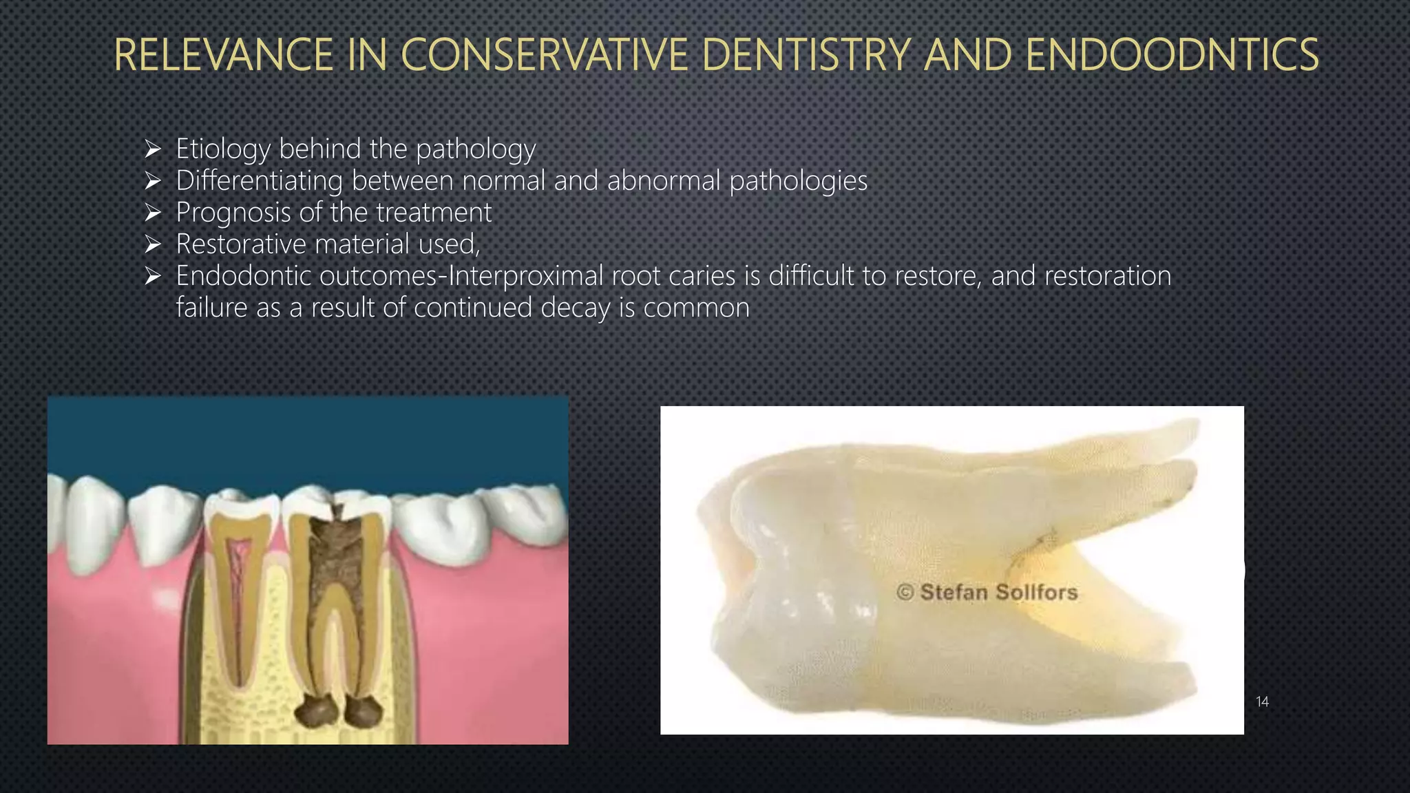 Age changes in tooth | PPTX