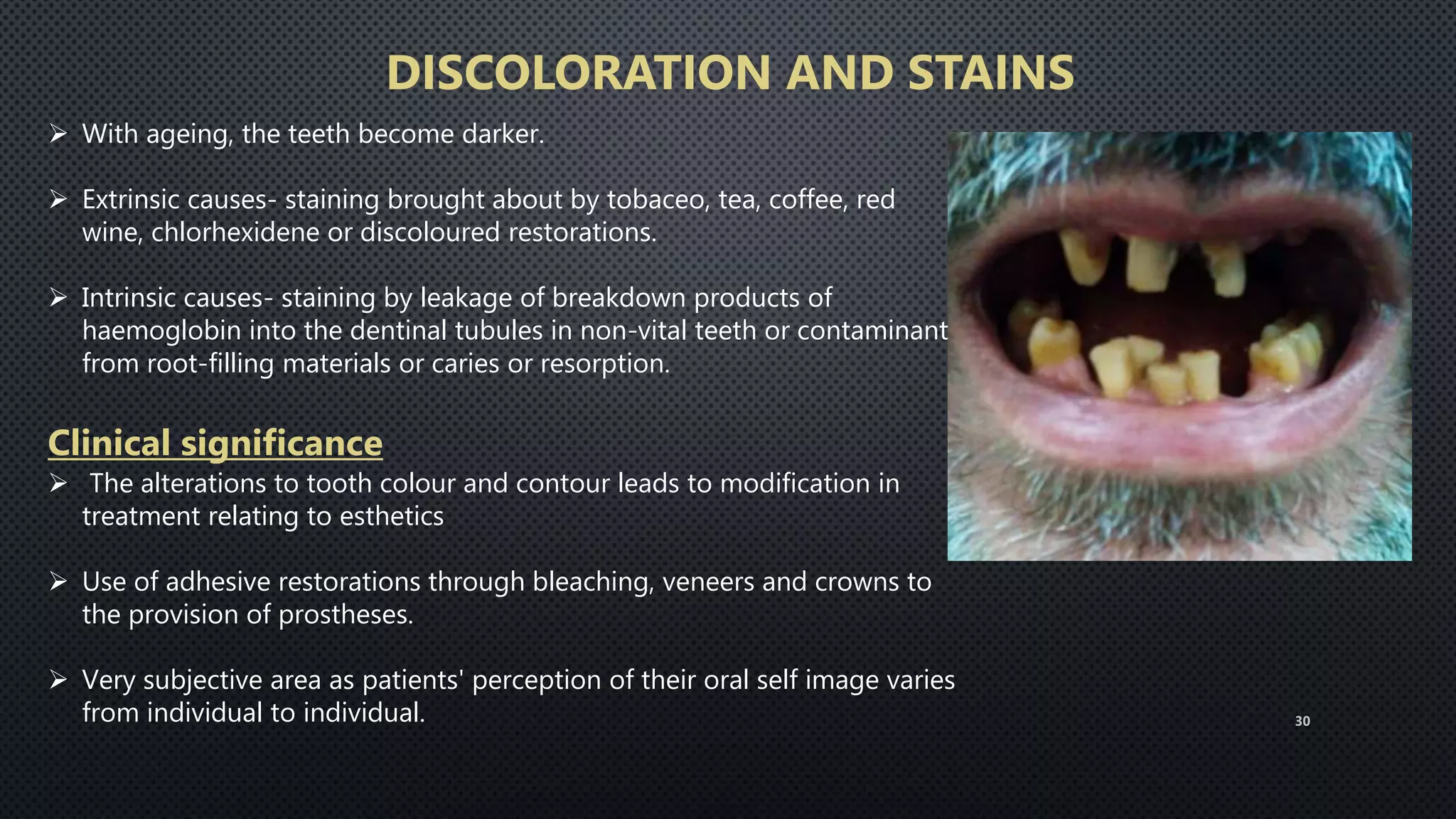 Age changes in tooth | PPTX