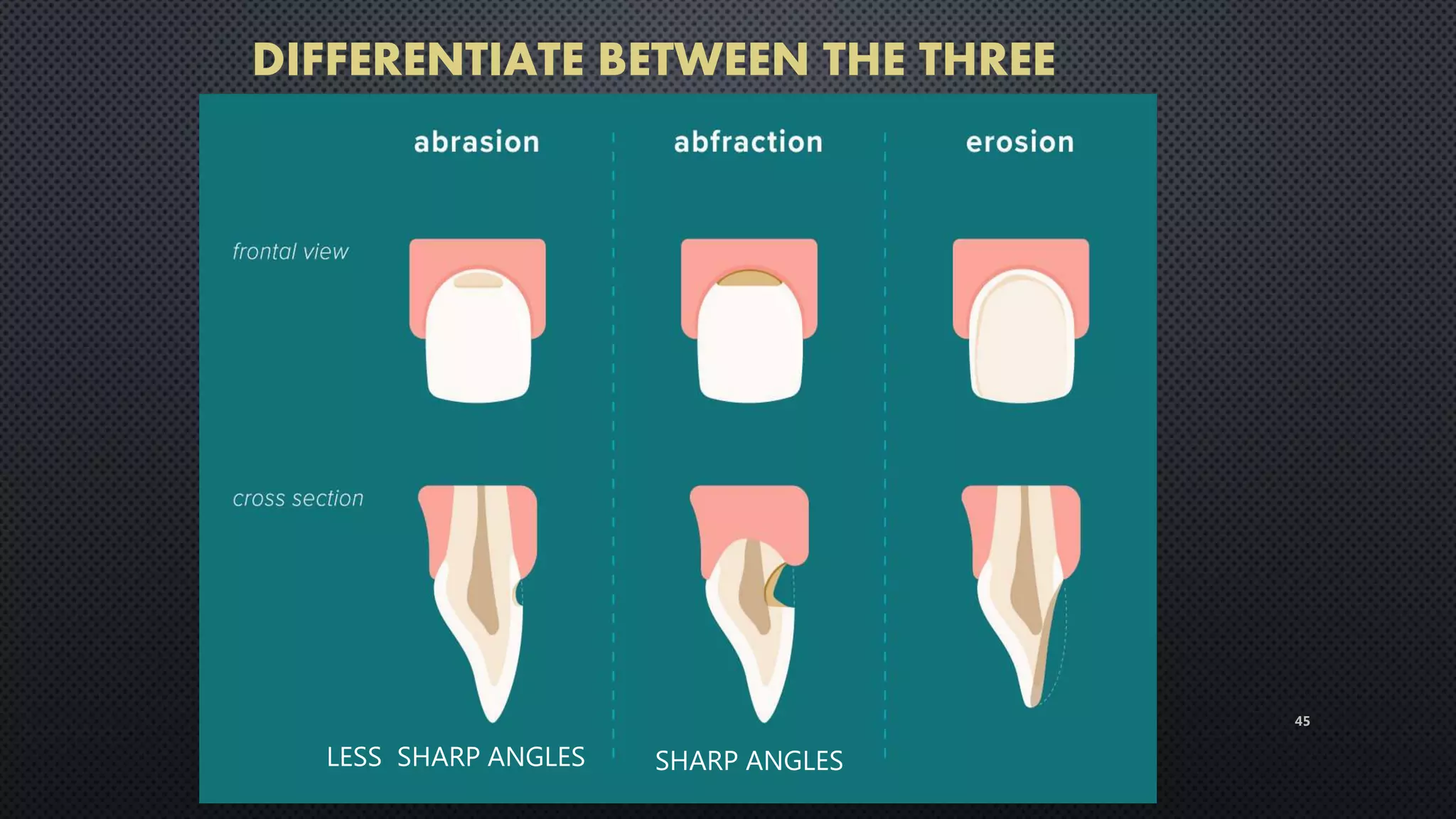 Age changes in tooth | PPTX