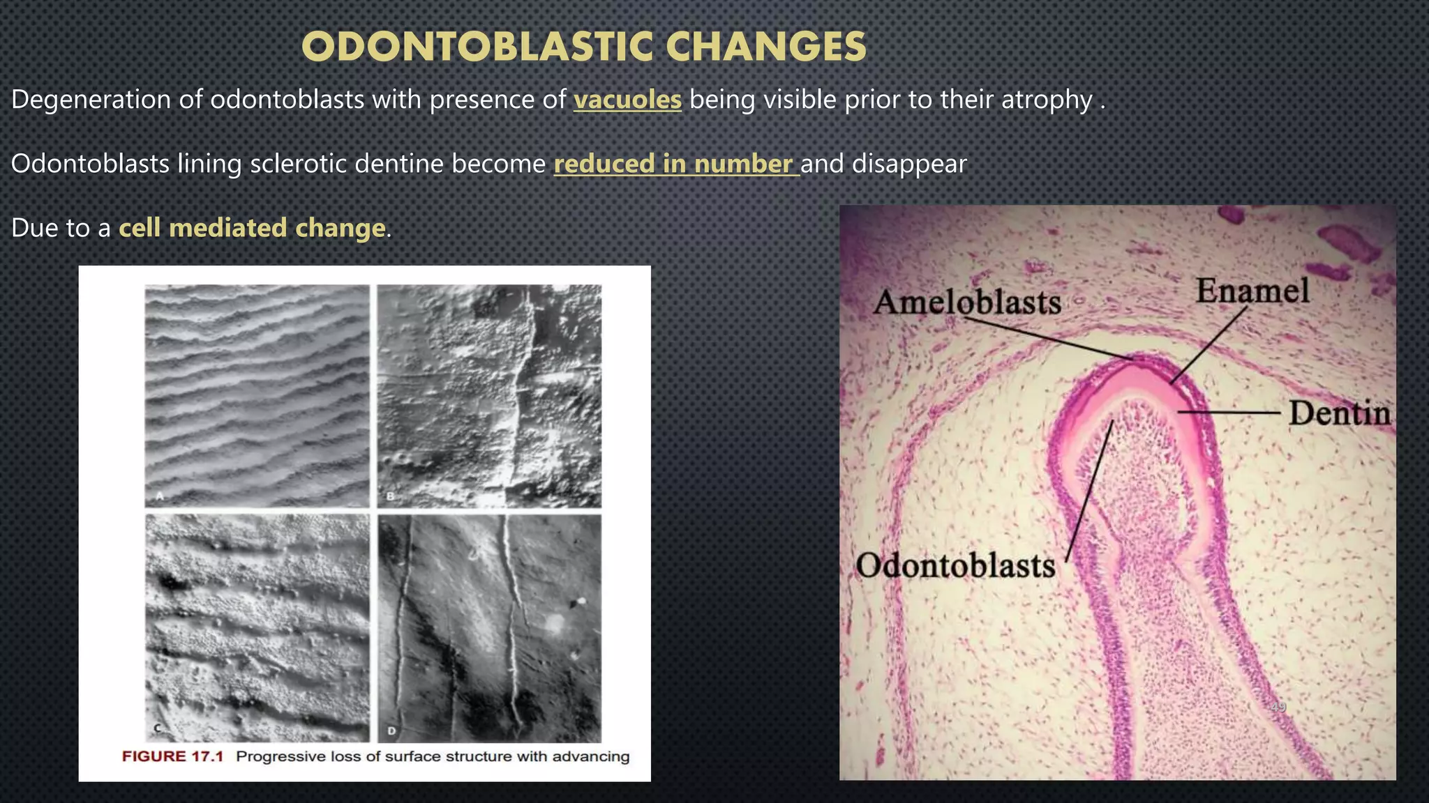 Age changes in tooth | PPTX