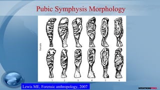 Pubic Symphysis Age