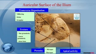Auricular Surface Age
