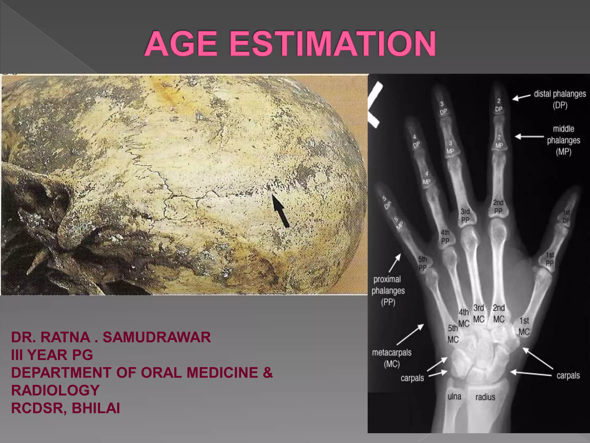 Age estimation | PPTX