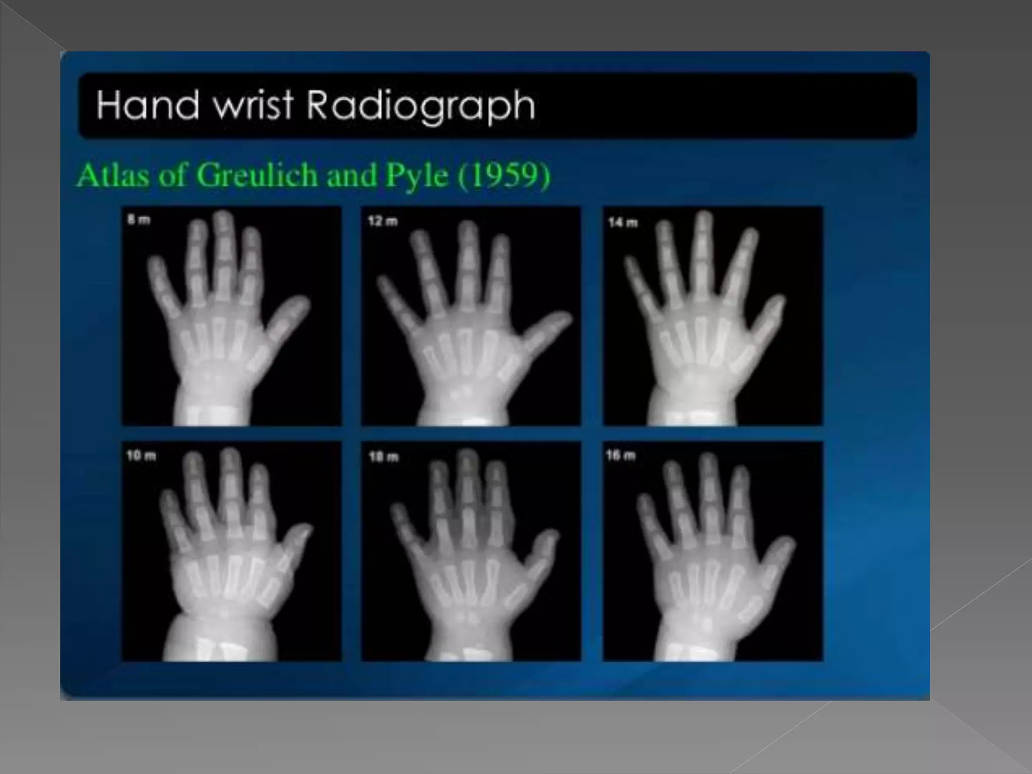 Age estimation | PPTX