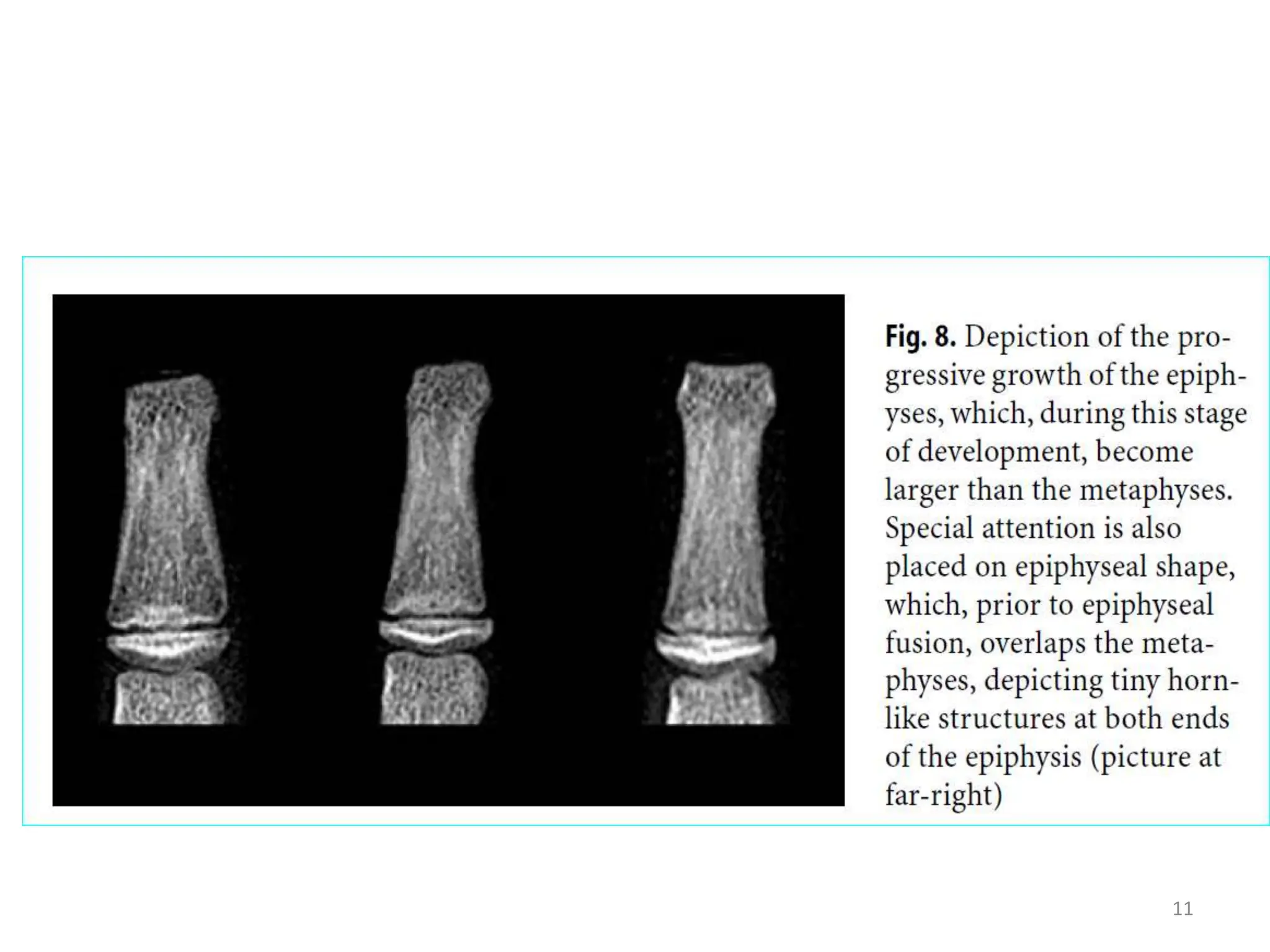Age Estimation By Radiological Method Using X Rays Pptx