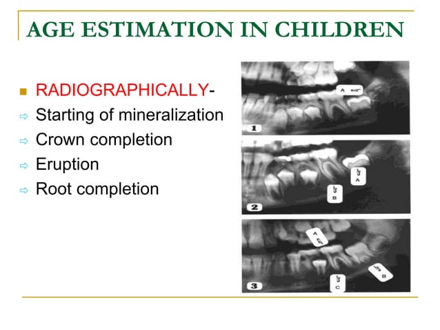 AGE ESTIMATION IN FORENSIC ODONTOLOGY.ppt | Oral care | Personal Care