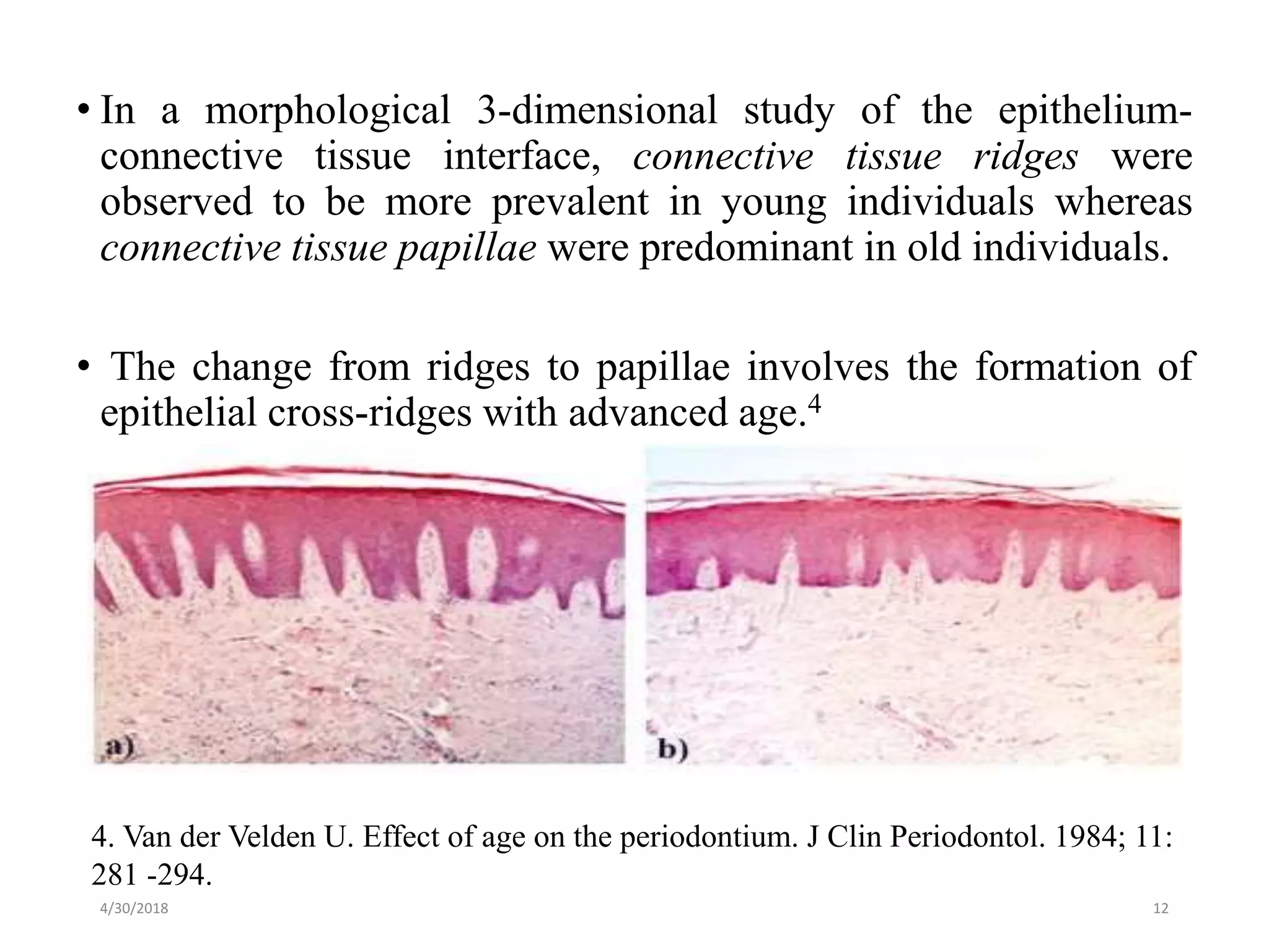 Ageing and the periodontium | PPTX