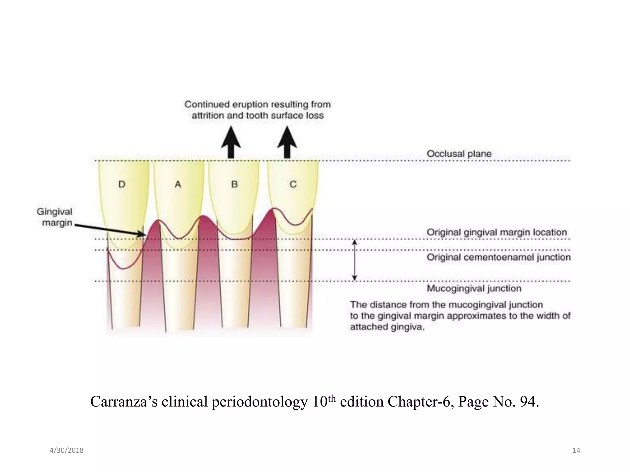 Ageing and the periodontium | PPTX