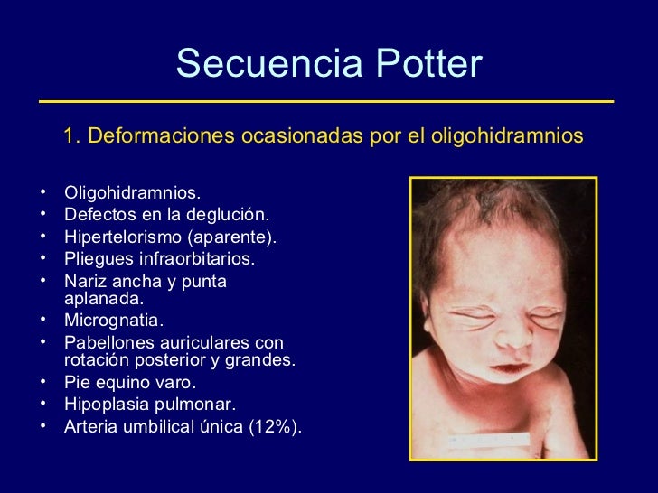 Agenesia renal