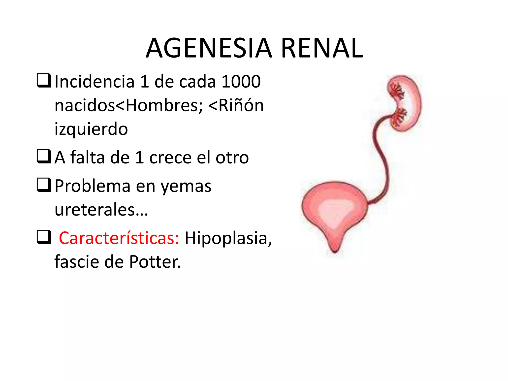 Agenesia renal | PPTX