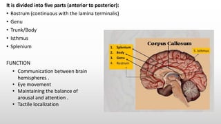 Agenesis of corpus callosum | PPTX