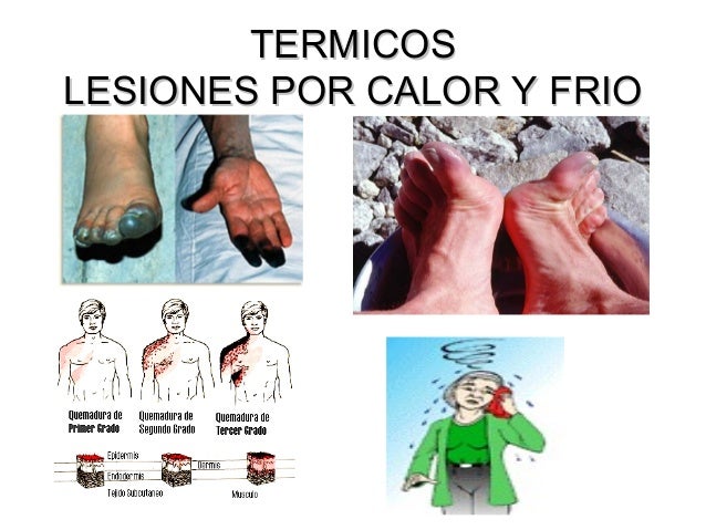 Agentes fisicos y quimicos