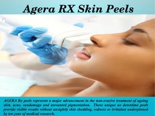 AGERA RX PEEL TREATMENT | PPT