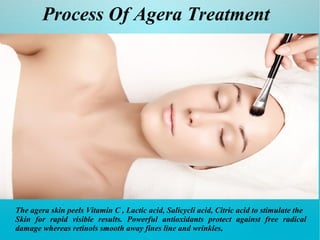 AGERA RX PEEL TREATMENT | PPT
