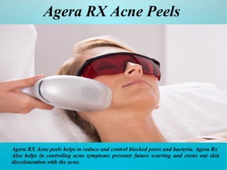 AGERA RX PEEL TREATMENT | PPT