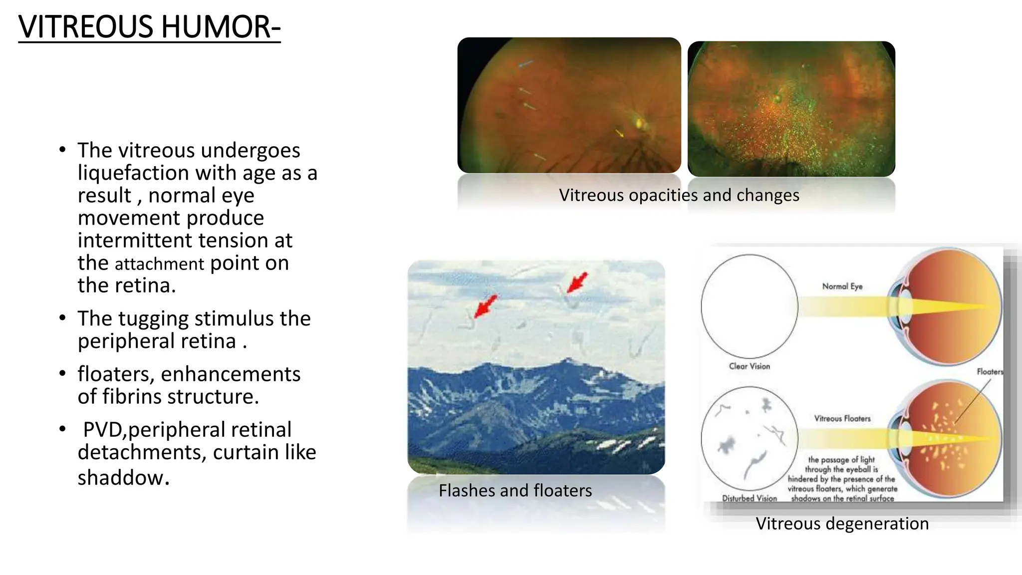 AGE RELATED CHANGES IN EYE(Eyelids, Conjunctiva, cornea, iris, pupil ...