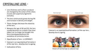 AGE RELATED CHANGES IN EYE(Eyelids, Conjunctiva, cornea, iris, pupil ...