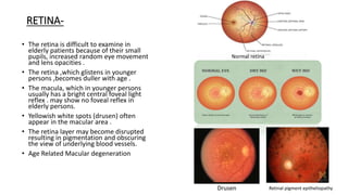 AGE RELATED CHANGES IN EYE(Eyelids, Conjunctiva, cornea, iris, pupil ...